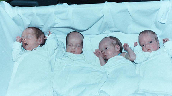 Indy’s First Quadruplets: Baby No. 3 Just… | Riley Children's Health