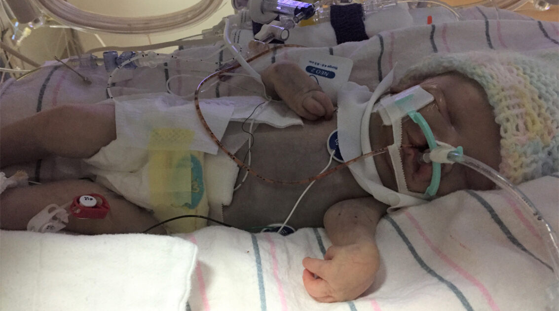 Rare Disease Day: Moms share personal… | Riley Children's Health