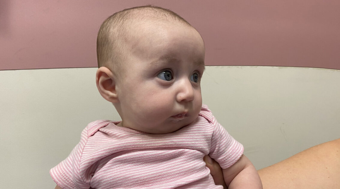 Cleft team helps guide baby’s growth | Riley Children's Health