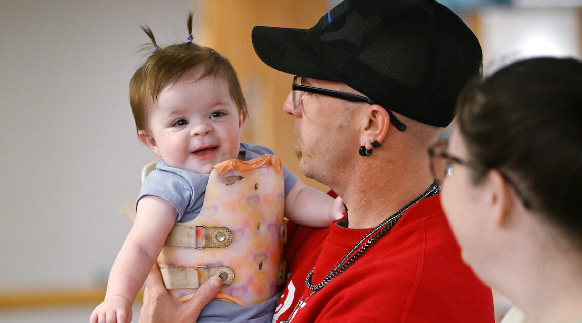 Spinal surgery on tiny tot requires a… | Riley Children's Health