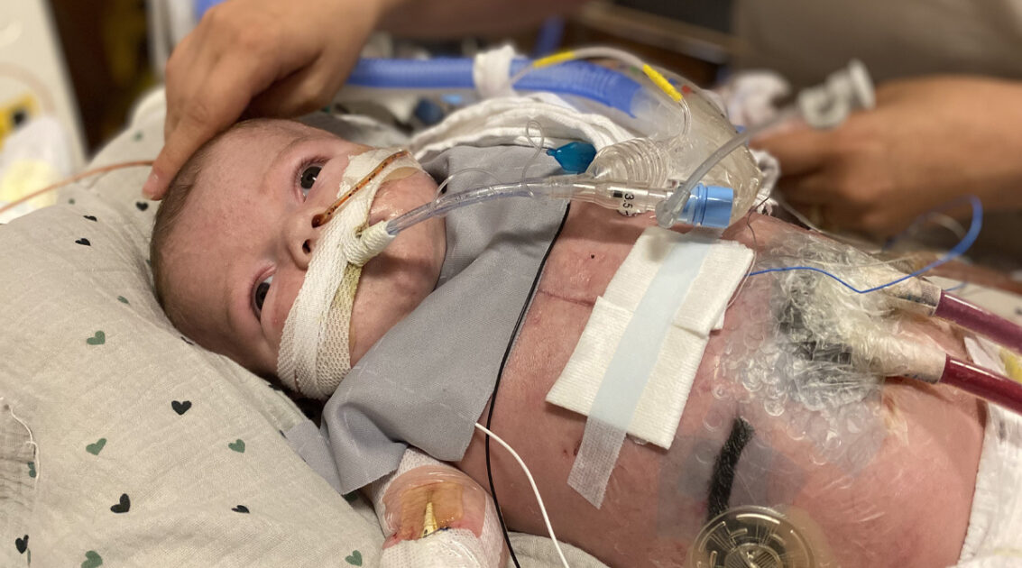 Norman might just be 1 in a million | Riley Children's Health