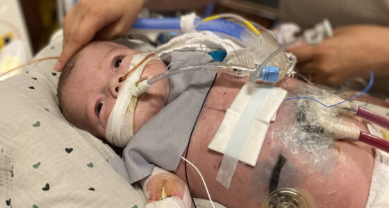 Cardiology I Indiana I Riley Children’s… | Riley Children's Health