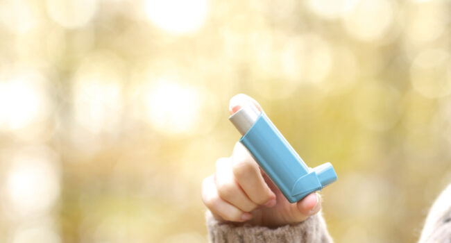 Bruises in Children: What’s Normal and When… | Riley Children's Health